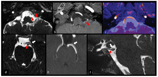 Three-Dimensional Constructive Interference in Steady State (3D CISS ...