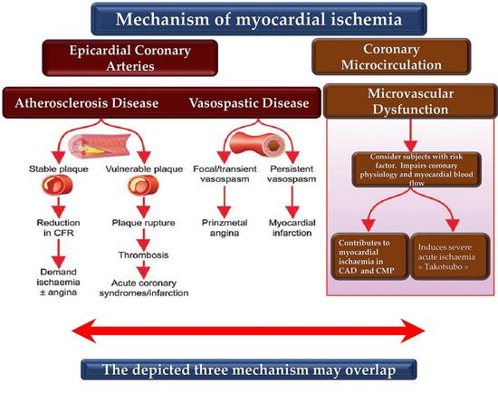 Biomedicines | Free Full-Text | Pathophysiology and Outcomes of Endothelium Function in Coronary ...