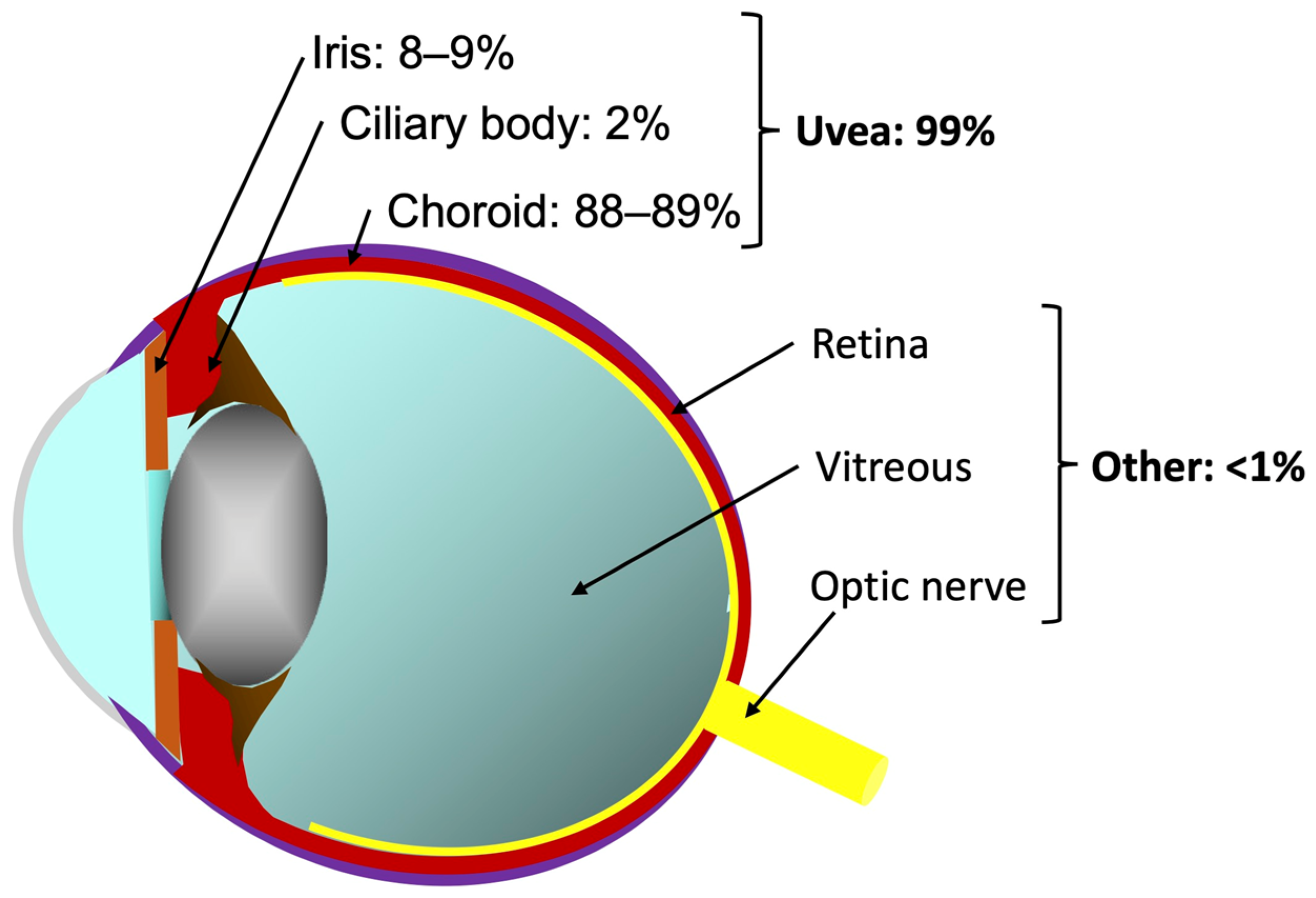 How to Manage a Patient with Ocular Metastases?