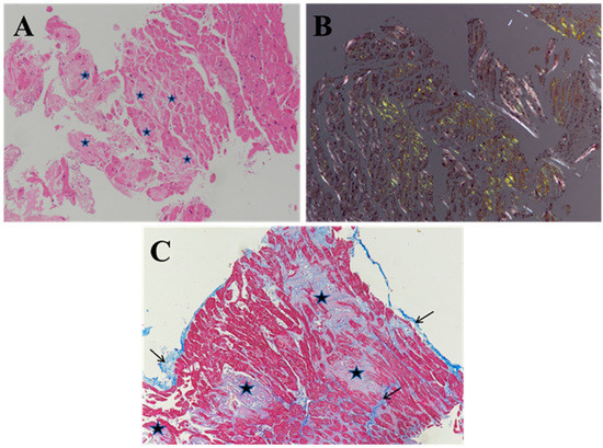 Biomedicines | Free Full-Text | Tissue Characterization in Cardiac ...