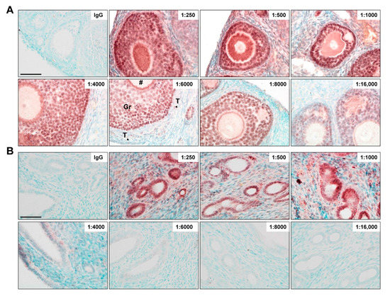 Immunohistochemical Detection of Estrogen Receptor-Beta (ERβ) with ...