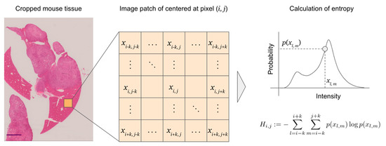 Pixel-Level Clustering of Hematoxylin–Eosin-Stained Sections of Mouse and Human Biliary Tract Cancer