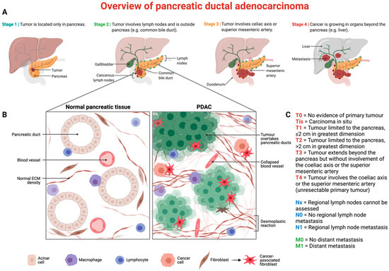 Where Do We Stand with Immunotherapy for Advanced Pancreatic Ductal Adenocarcinoma: A Synopsis ...