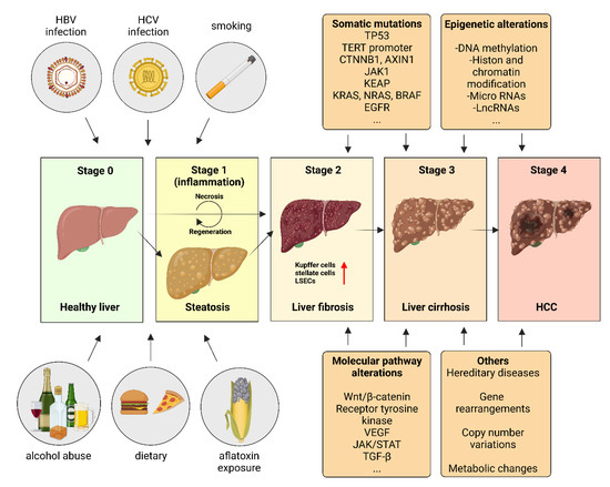 Biomedicines | Free Full-Text | Pathogenesis and Current Treatment Strategies of Hepatocellular ...