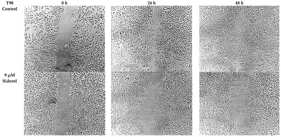 Siderol Inhibits Proliferation of Glioblastoma Cells and Acts ...