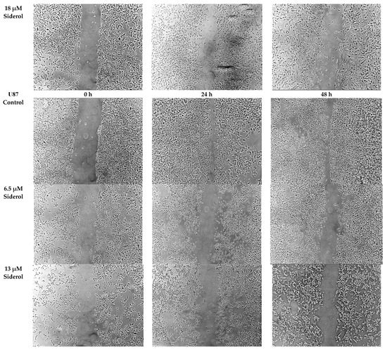Siderol Inhibits Proliferation of Glioblastoma Cells and Acts ...