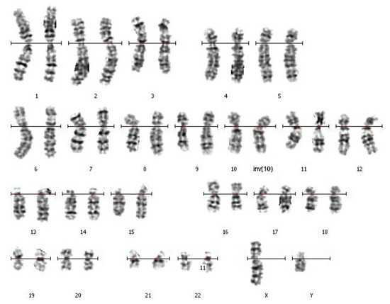 Chromosomal Inversion In Humans