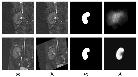 Biomedicines | Free Full-Text | Variational Approach for Joint Kidney Segmentation and ...