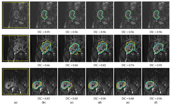 Biomedicines | Free Full-Text | Variational Approach for Joint Kidney Segmentation and ...