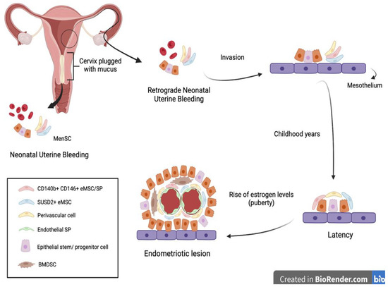 The Emerging Role of Menstrual-Blood-Derived Stem Cells in Endometriosis