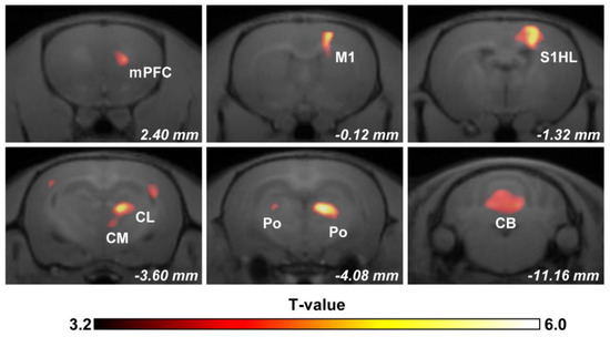 FDG PET Imaging of the Pain Matrix in Neuropathic Pain Model Rats