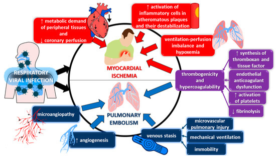 Cardiovascular Complications of Viral Respiratory Infections and COVID-19
