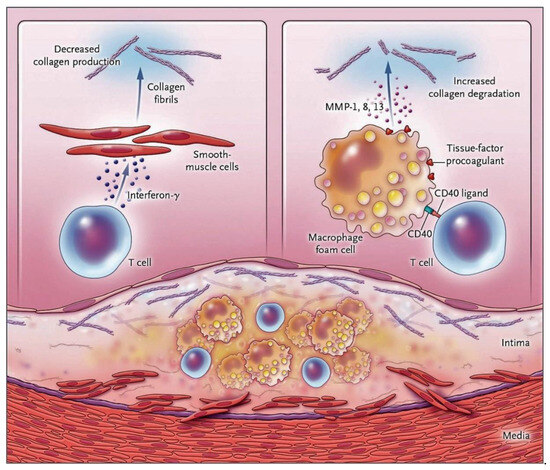 Biomedicines | Free Full-Text | Worsening Thrombotic Complication of ...