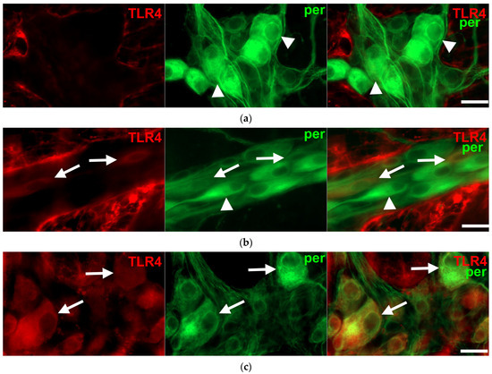 Intestinal Region-Dependent Alterations of Toll-Like Receptor 4 ...