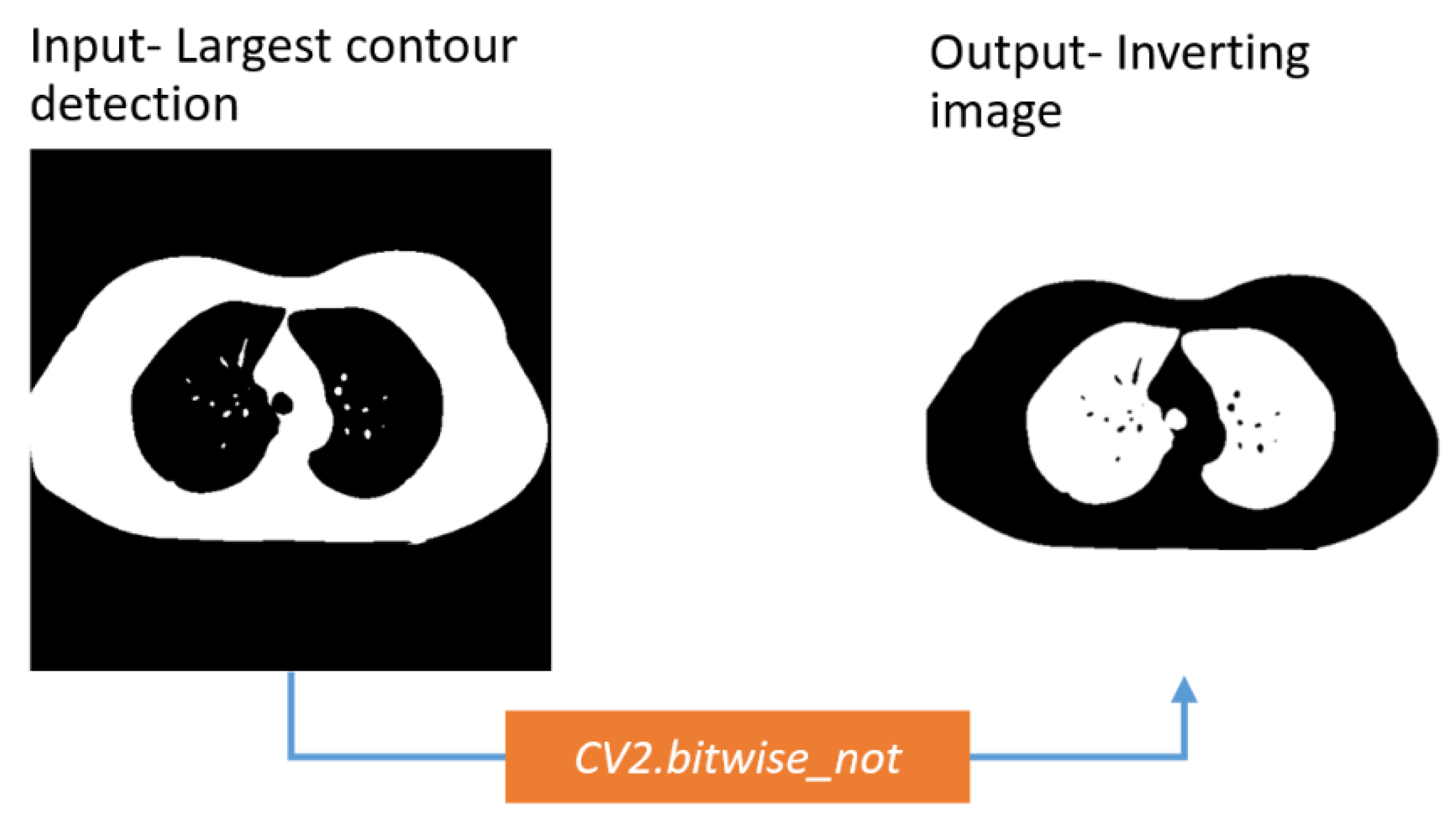 Automated Detection of Broncho-Arterial Pairs Using CT Scans Employing ...
