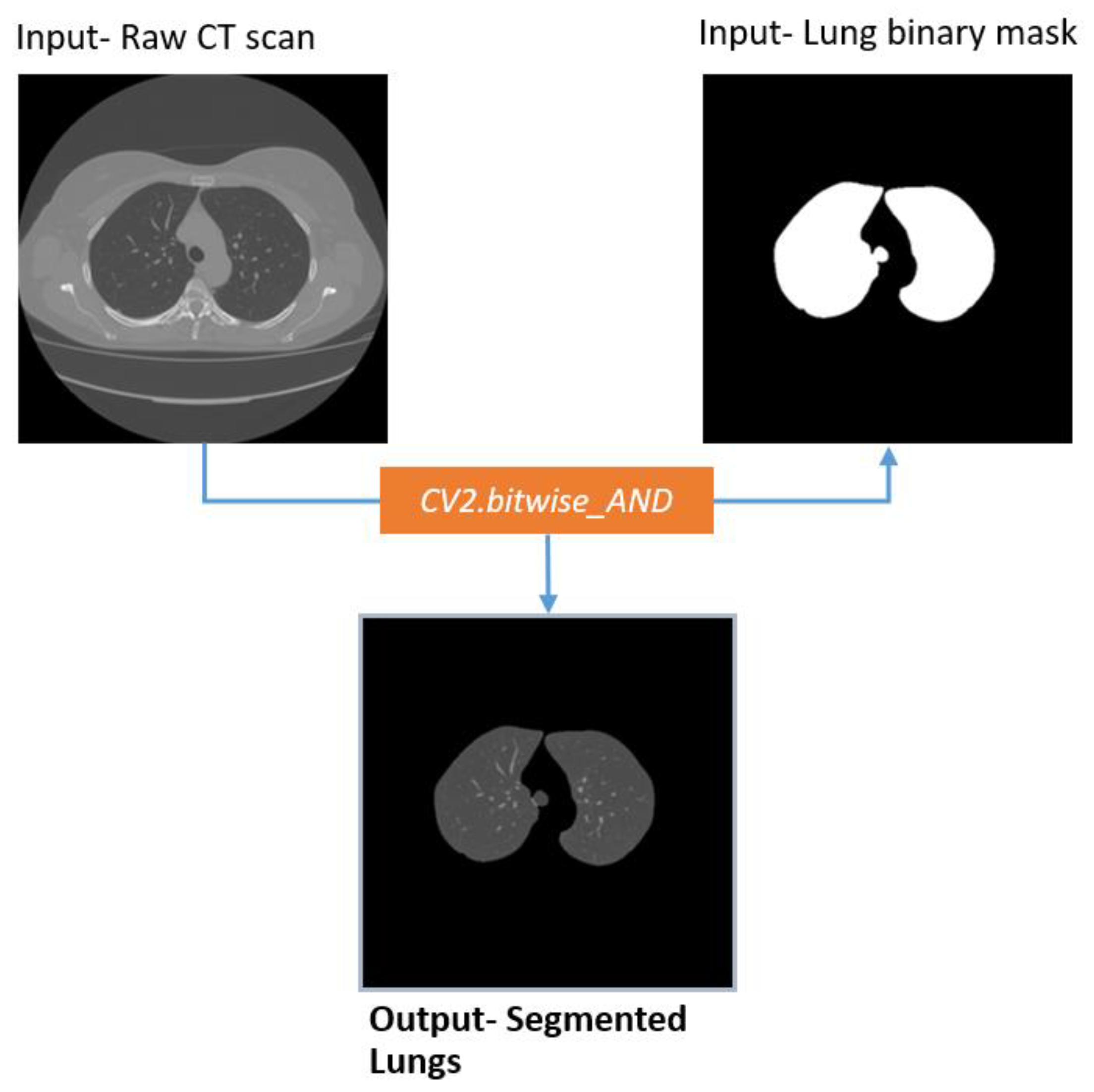 Automated Detection of Broncho-Arterial Pairs Using CT Scans Employing Different Approaches to ...