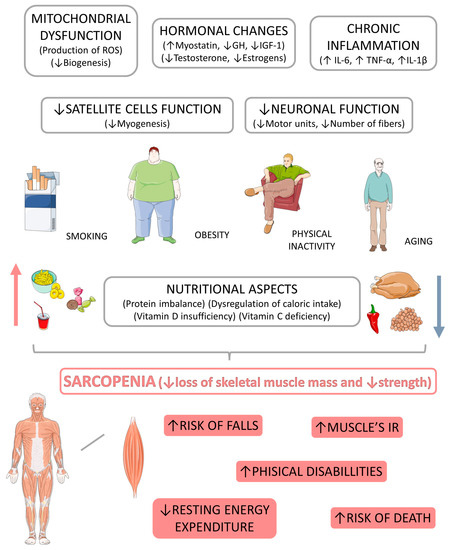 Insights into Pathogenesis, Nutritional and Drug Approach in Sarcopenia ...
