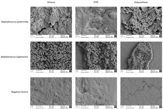 Biofilms on Indwelling Artificial Urinary Sphincter Devices Harbor ...