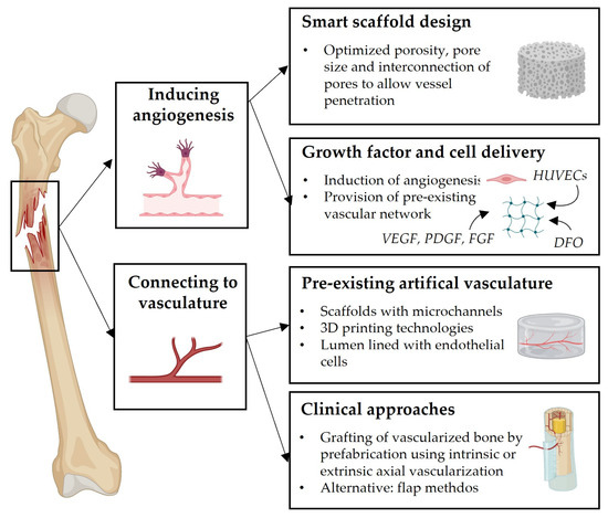 Scaffold Guided Bone Regeneration for the Treatment of Large Segmental Defects in Long Bones
