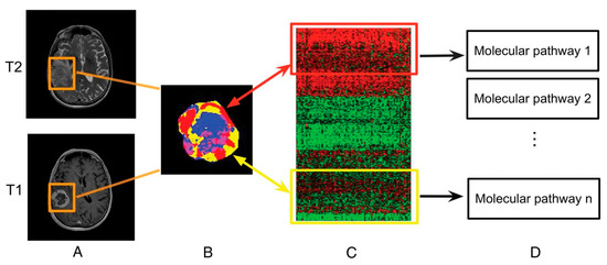 Magnetic Resonance Imaging of Primary Adult Brain Tumors: State of the Art and Future Perspectives