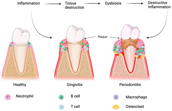 The Role and Involvement of Stem Cells in Periodontology