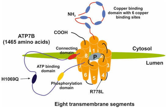 A Century of Progress on Wilson Disease and the Enduring Challenges of ...