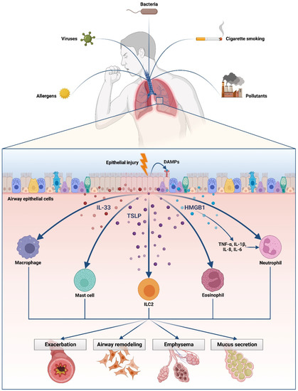 TSLP and HMGB1: Inflammatory Targets and Potential Biomarkers for Precision Medicine in Asthma ...
