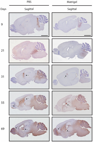 Towards Standardisation of a Diffuse Midline Glioma Patient-Derived ...