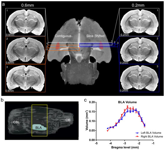 Seeking the Amygdala: Novel Use of Diffusion Tensor Imaging to ...
