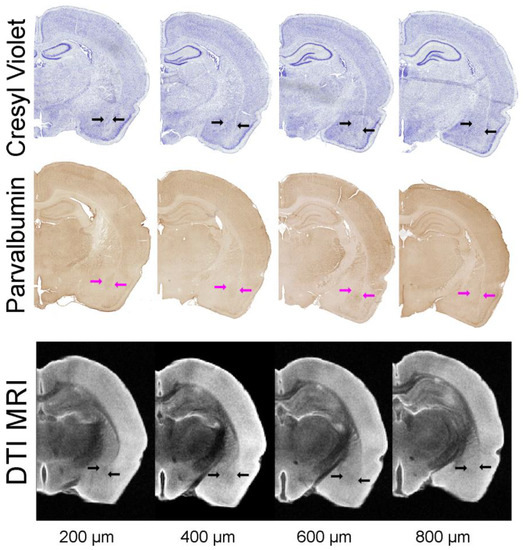 Seeking the Amygdala: Novel Use of Diffusion Tensor Imaging to ...