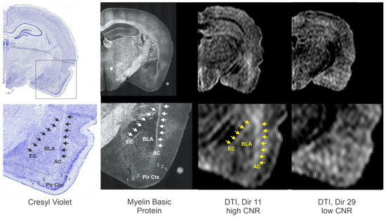 Seeking the Amygdala: Novel Use of Diffusion Tensor Imaging to ...