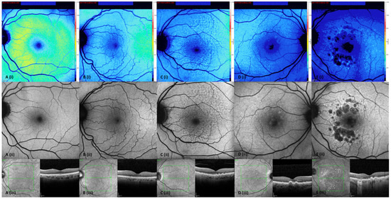Biomedicines | Free Full-Text | Quantitative Autofluorescence in Non ...