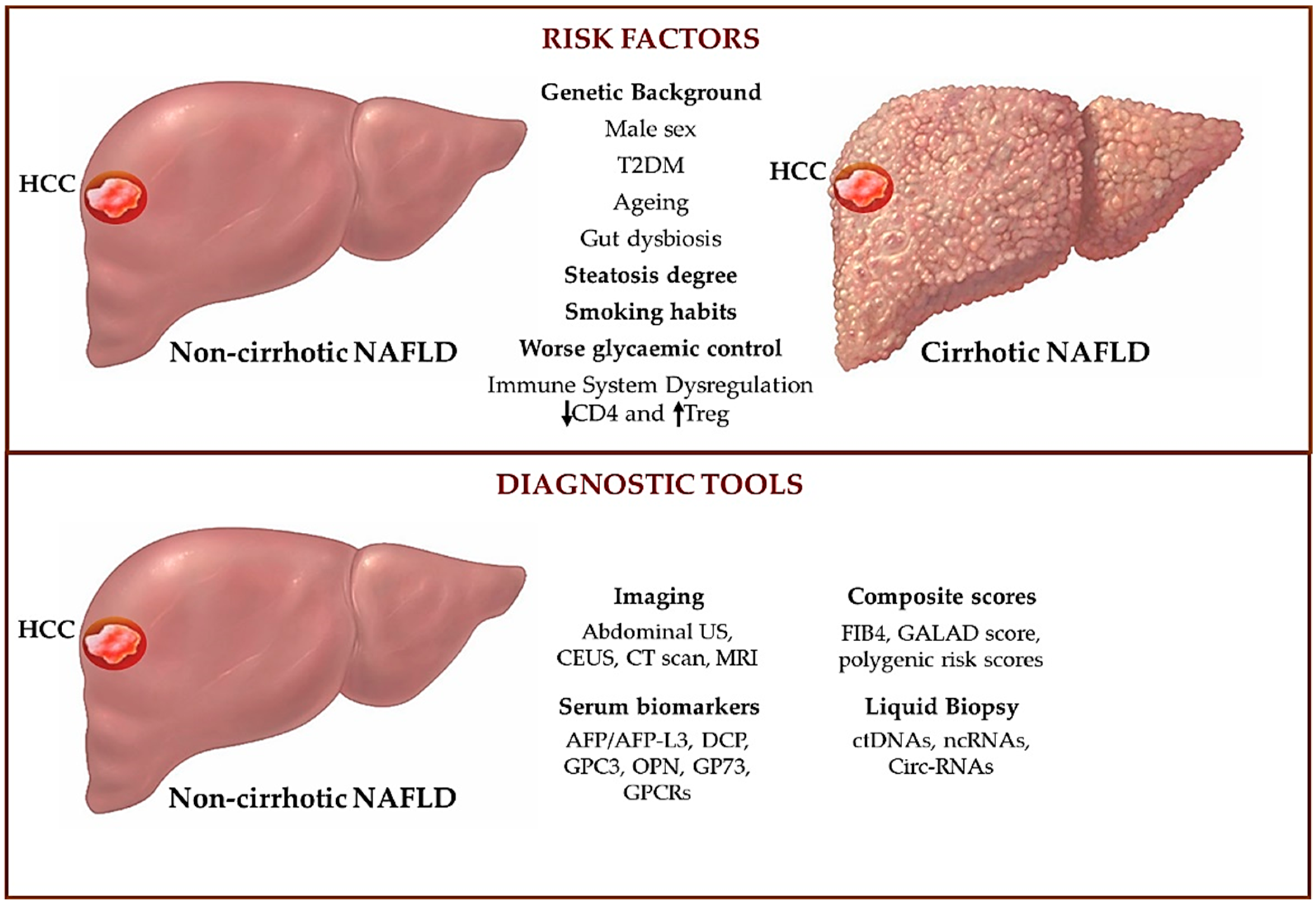 Risk Factors For Nafld - vrogue.co Risk Factors For Nafld - vrogue.co