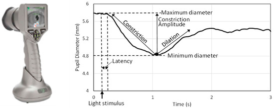 Pupillary Light Response Deficits in 4-Week-Old Piglets and Adolescent ...
