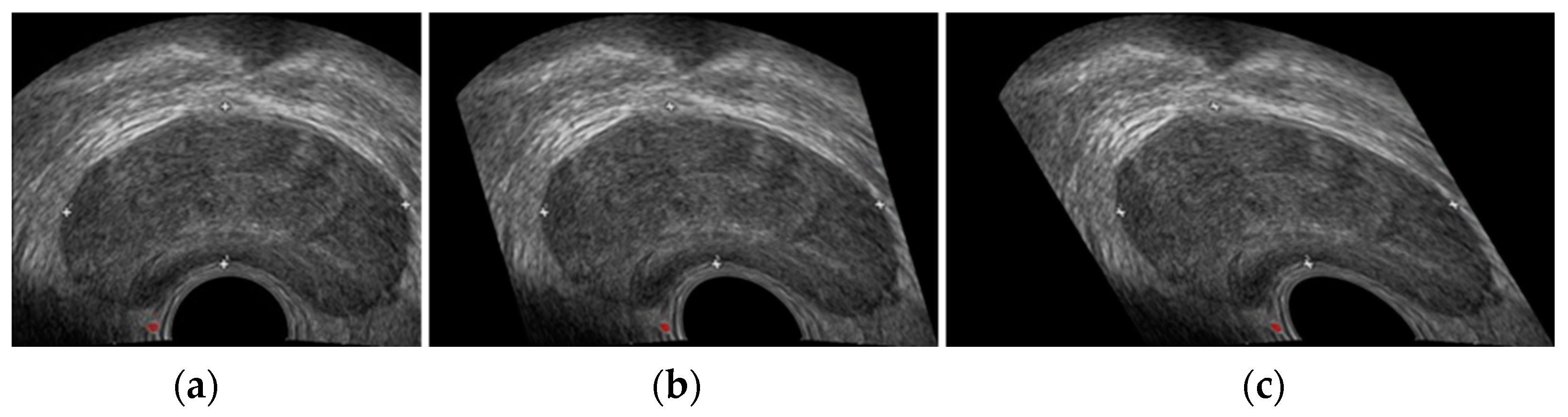 Prostate Ultrasound Image Segmentation Based on DSU-Net