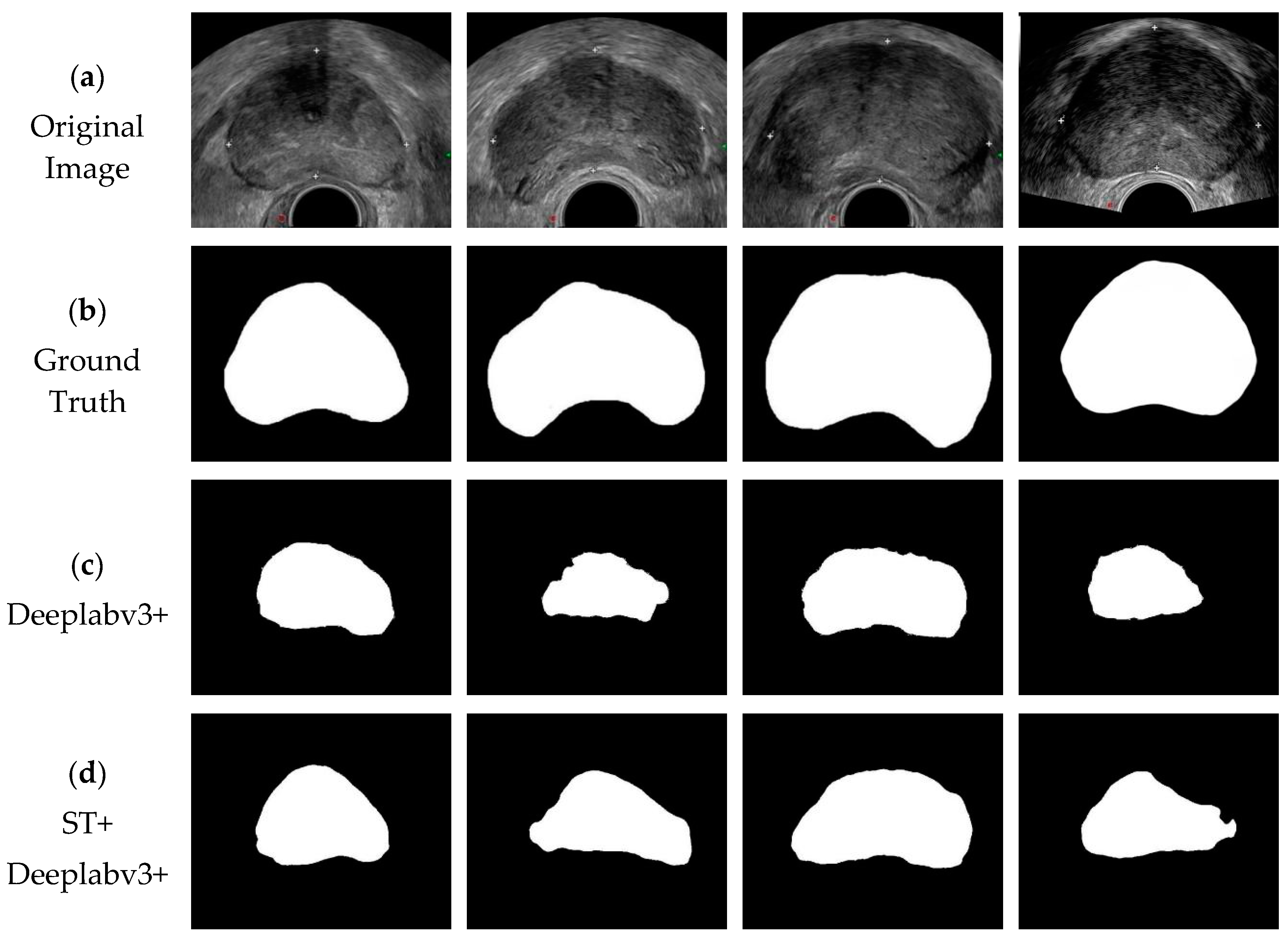 Prostate Ultrasound Image Segmentation Based on DSU-Net