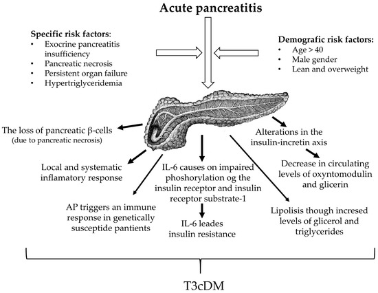 The Cause and Effect Relationship of Diabetes after Acute Pancreatitis