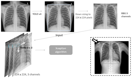Machine Learning Using Xception A Deep Convolutional Neural Network Architecture To Implement