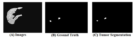 Biomedicines | Free Full-Text | Detection of Liver Tumour Using Deep ...