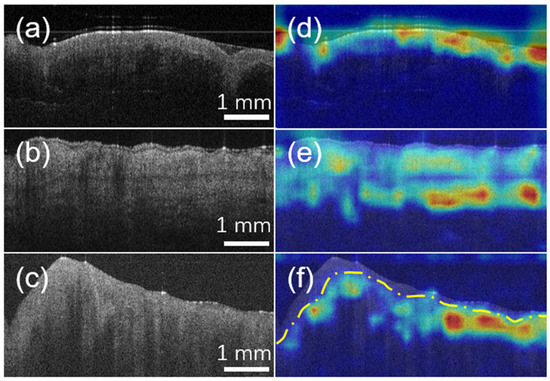 Deep-Learning-Based Automated Identification and Visualization of Oral ...