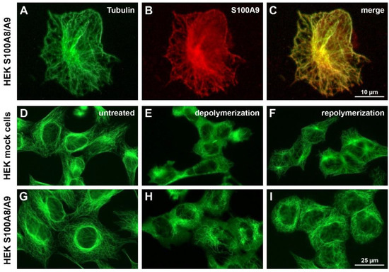 S100A8/S100A9 Integrates F-Actin and Microtubule Dynamics to Prevent ...