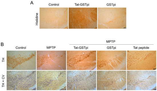Tat-GSTpi Inhibits Dopaminergic Cells against MPP+-Induced Cellular ...