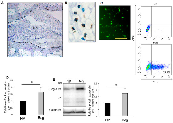 Bag-1 Protects Nucleus Pulposus Cells from Oxidative Stress by ...