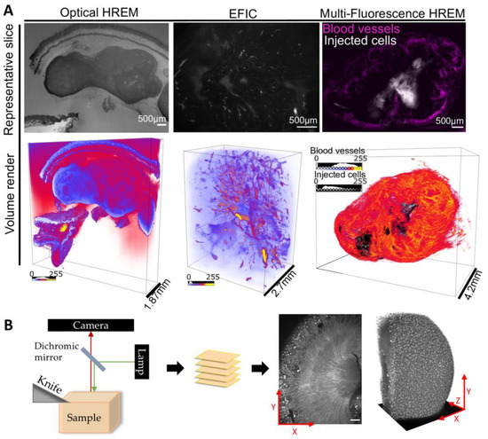 Quantitative Image Processing for Three-Dimensional Episcopic Images of ...