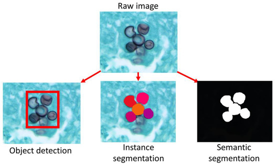 Quantitative Image Processing for Three-Dimensional Episcopic Images of ...