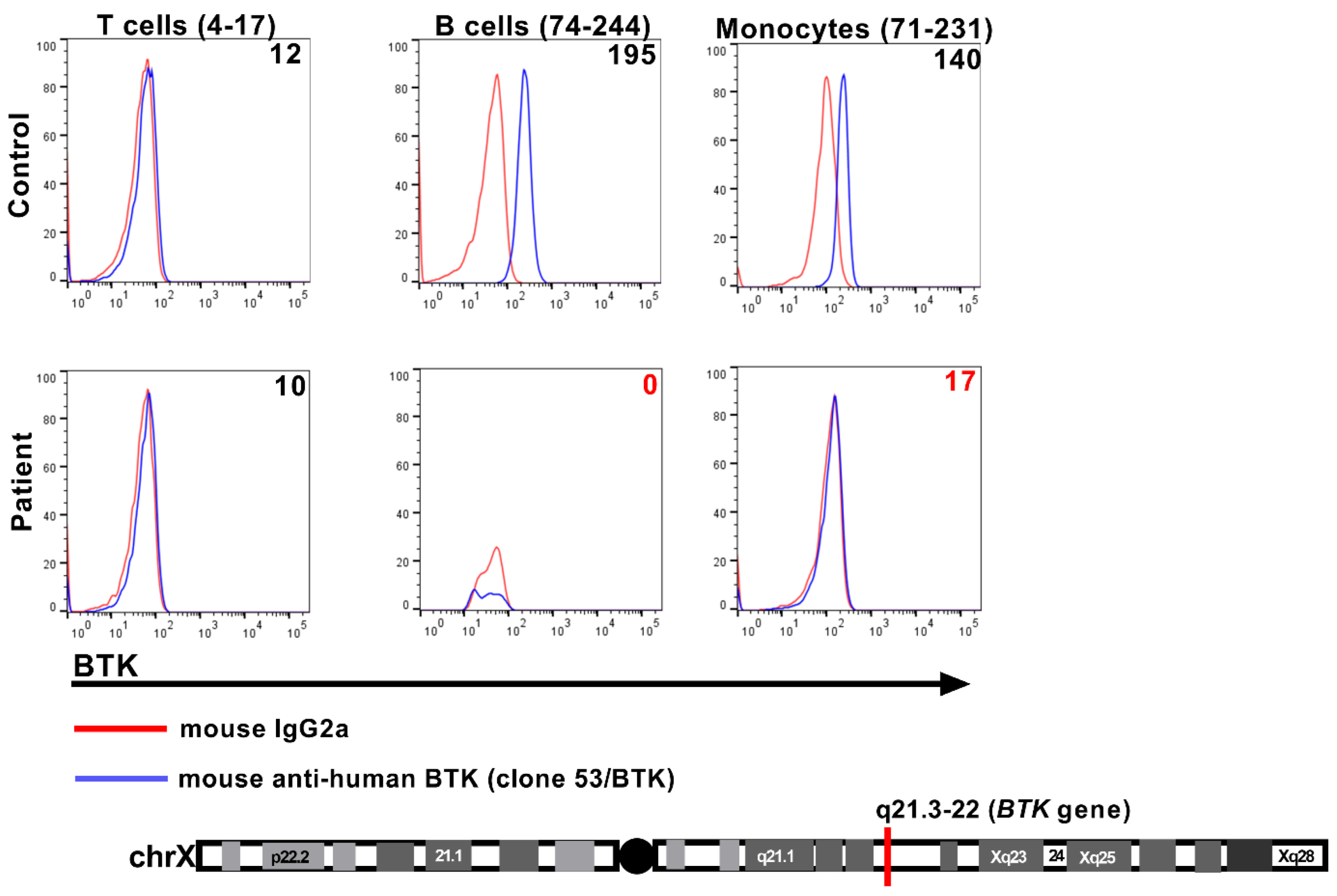 Co-Occurring X-Linked Agammaglobulinemia and X-Linked Chronic Granulomatous Disease: Two ...