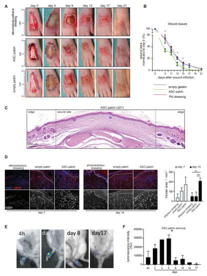 Adipose-Derived Stromal Cells within a Gelatin Matrix Acquire Enhanced ...