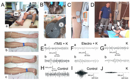 The Role of Transcranial Magnetic Stimulation, Peripheral ...