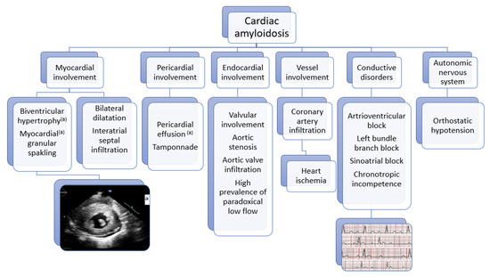 State of the Art of Cardiac Amyloidosis