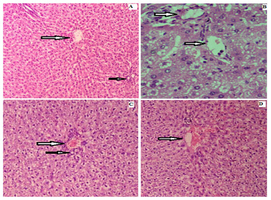 Formulation and Optimization of Repaglinide Nanoparticles Using ...